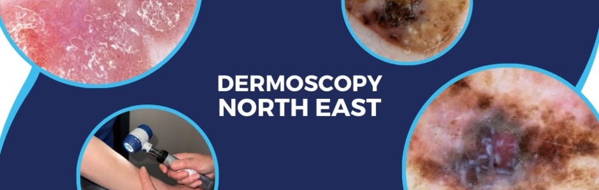 BUY TICKETS – Dermoscopy Seminar Saturday 4 October 2025. – The ...